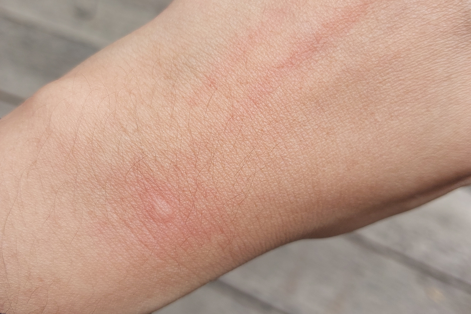 Wespe, Gelse oder doch Bremse? Dieses Insekt hat dich gestochen